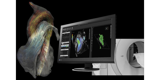 Cardio Flow Design、放射線科ソフト国内販売1位のアミン株式会社と業務提携～血流解析ソフト「iTFlow2」 | 映像情報 ...