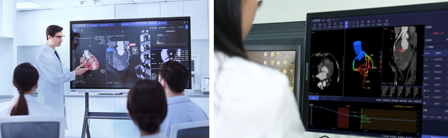 クレアボ・テクノロジーズ、数坤科技社（Shukun）冠動脈造影CT画像診断支援ソフトウェアおよび循環動態解析プログラム 日本における独占開発 ...