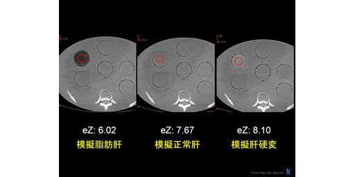 Liver Phantom を用いたDual Energy CTにおけるEffective-Zの精度評価 | 映像情報Medical