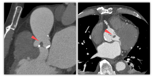タグ「2024 Philips Build Out Cup」の検索結果 | 映像情報Medical
